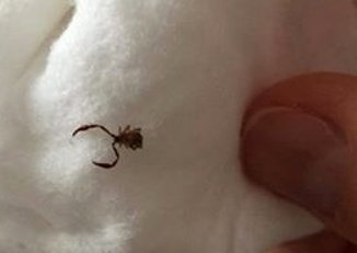 Klíště.cz – Létající klíště a další druhy živočichů podobné klíšťatům